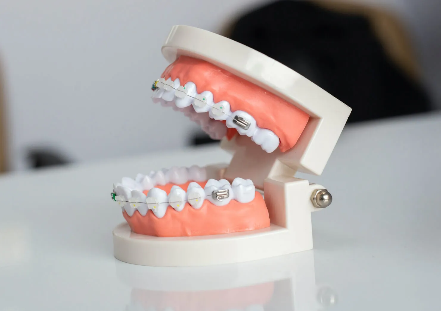 Orthodontic Treatment | Top Dentists and Orthodontists in Shanghai ...