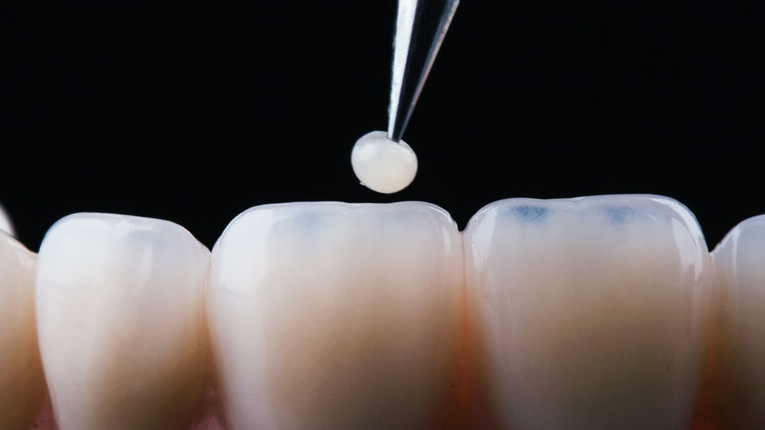 Best Restorative Dentistry Techniques in Shanghai: Explore Advanced ...